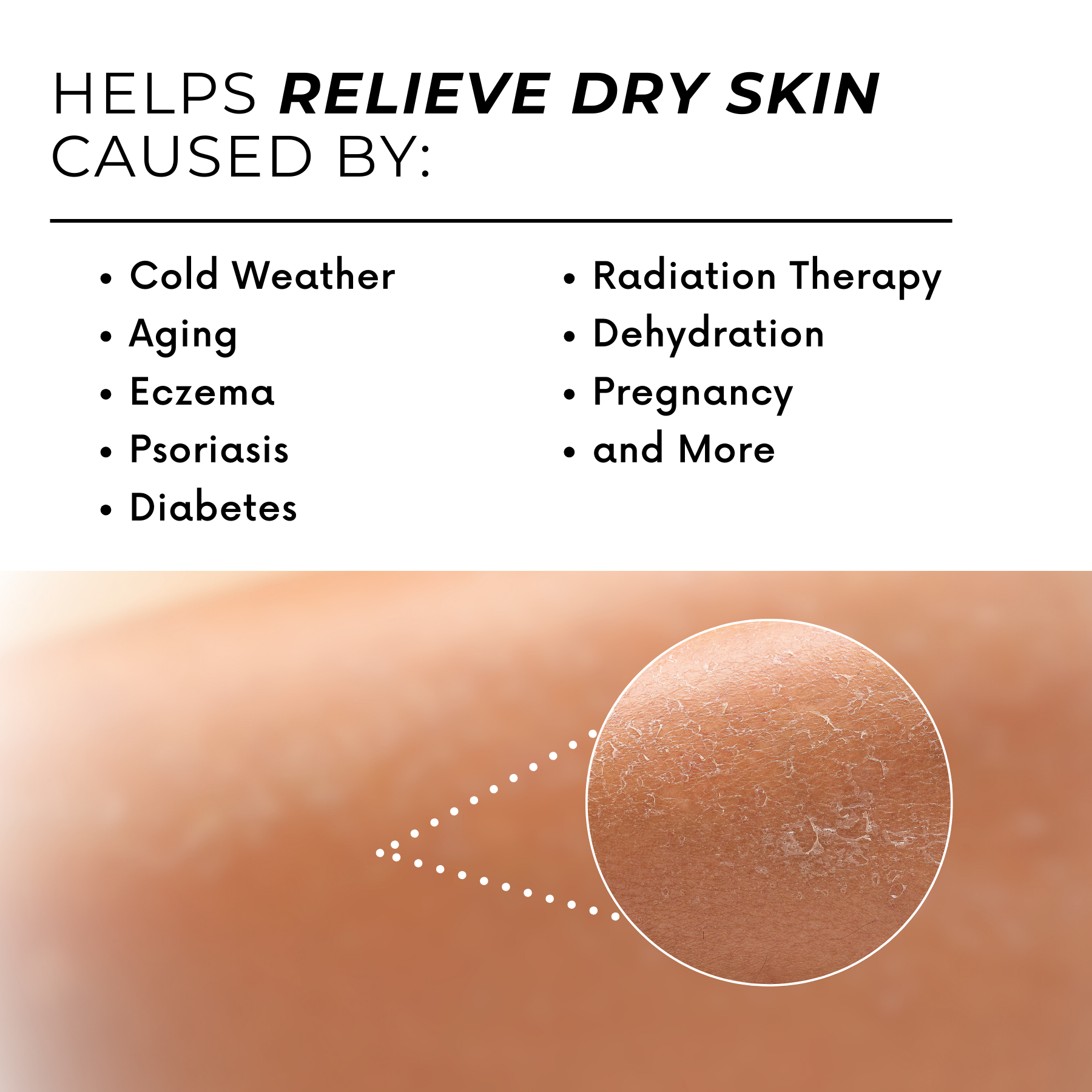 Activated Ghee Body Balm - Best Extra Dry Skin Moisturizer for Eczema ...